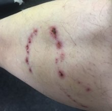 Australia Post dog attacks: Worst states for dog attacks on posties ...