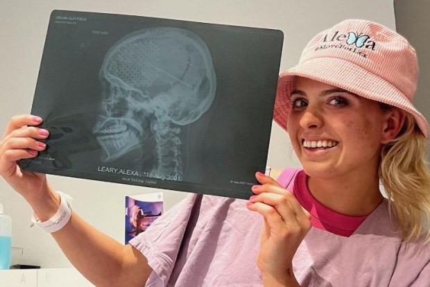 Swimming news 2024: Alexa Leary's recovery from horrific bike accident ...