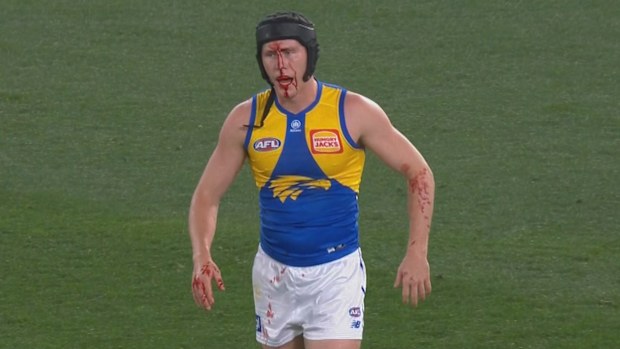 AFL News 2026: Melbourne star Kysaiah Pickett in hot water for high ...