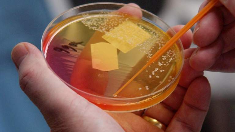 Golden staph infections rising in community, GPs blame antibiotic overuse