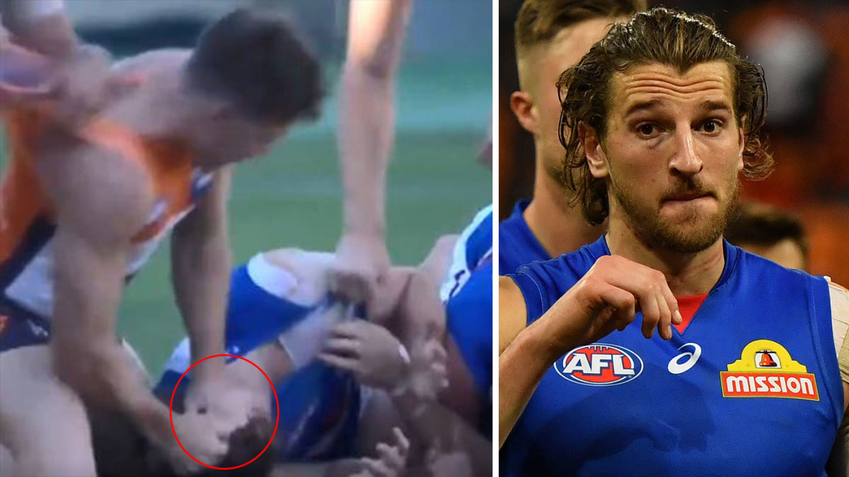AFL: Toby Greene sent to Tribunal for alleged eye goug on Marcus ...