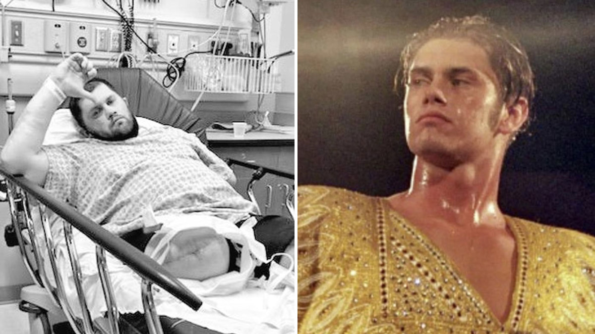 Jimmy Rave dead at 39 months after triple amputation due to MRSA in ...