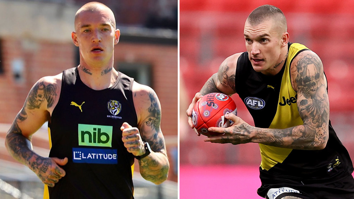 AFL: Dustin Martin returns to training 10kg lighter after kidney injury ...