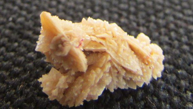 Prostate drug makes it easier for men and women to pass kidney stones