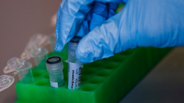 Scientists create sheep that can grow human organs