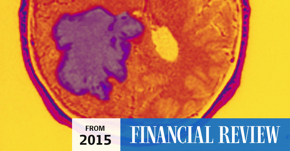 Traces of metal left in brain after MRI scan: does it matter?