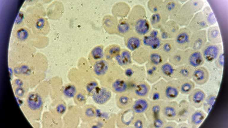 Queensland scientists develop millions of parasites to stop spread of ...