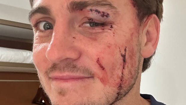 Wallabies vs British and Irish Lions tour 2025: James O'Connor ...