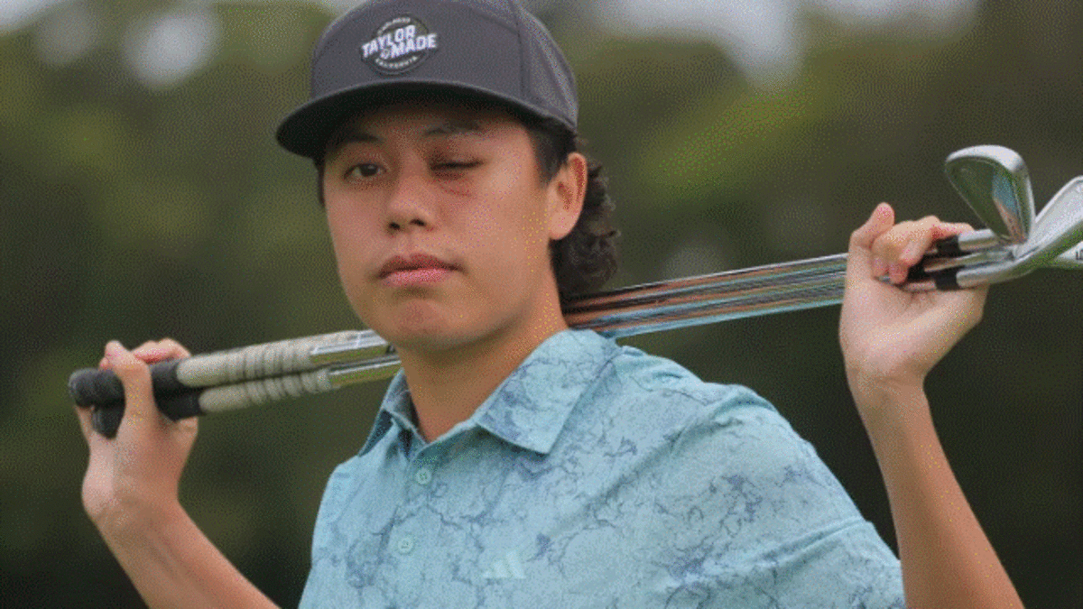 Golf news 2024: Jeff Guan injury; left eye; career under cloud | Nine ...