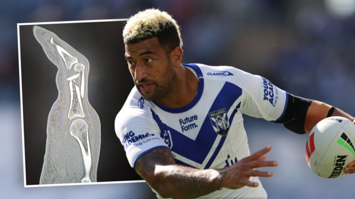 NRL news 2024: Viliame Kikau x-ray, ruled out for up to six weeks, Phil ...