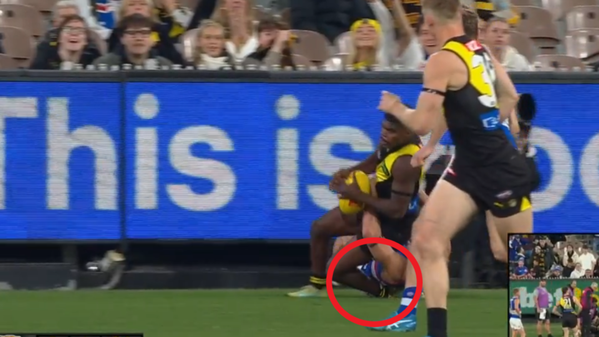 AFL News 2024: Richmond vs Western Bulldogs, Maurice Rioli leg injury ...