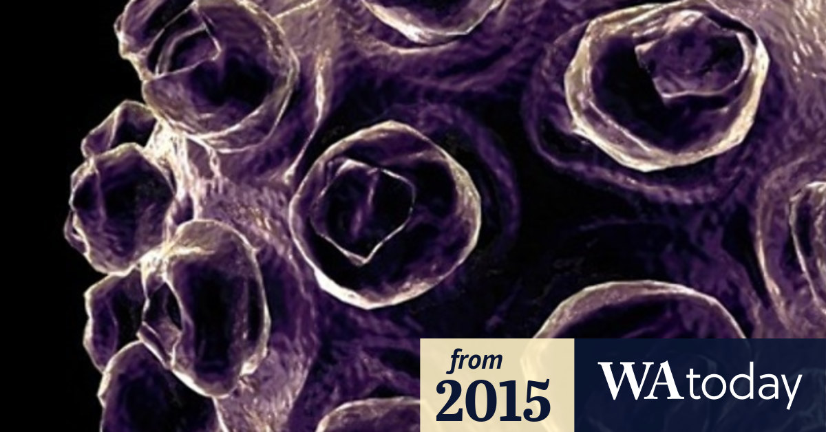 Measles warning for Perth-bound flight