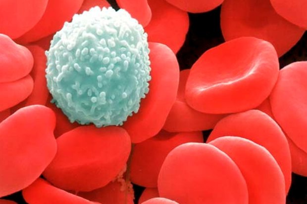 Scientists watch a human cell explode and die on camera for the first time