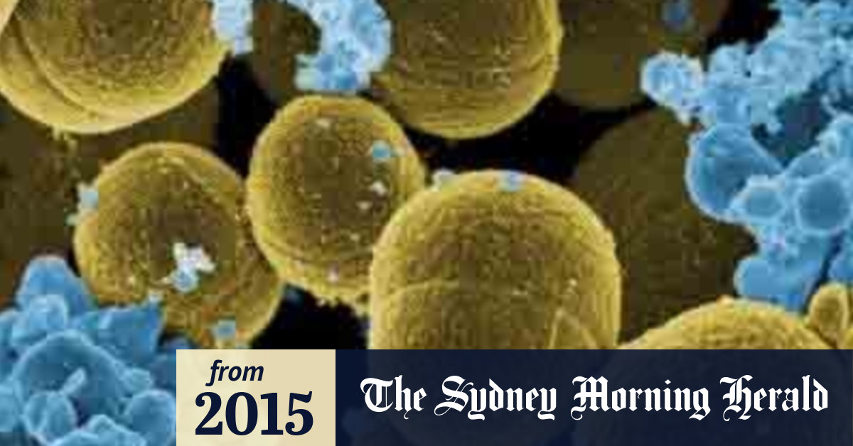 MRSA superbug could be killed by a 1100-year-old home remedy ...