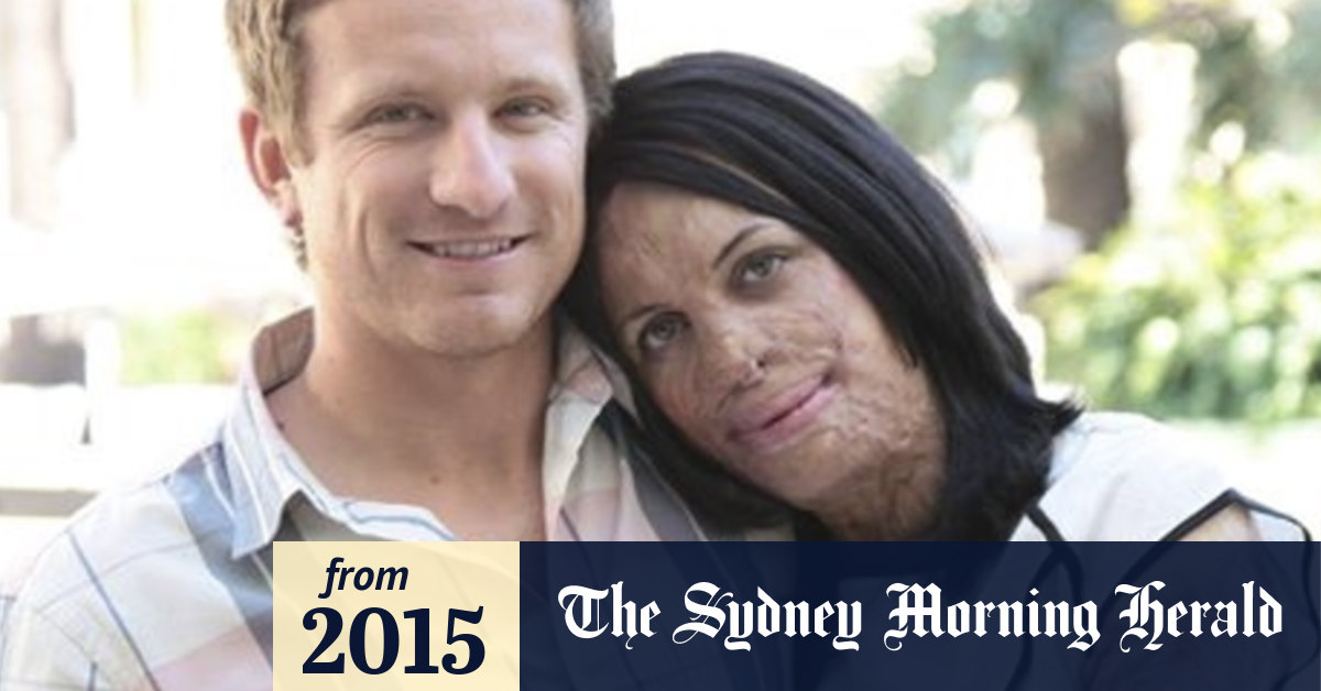Burns survivor Turia Pitt engaged to partner Michael Hoskin