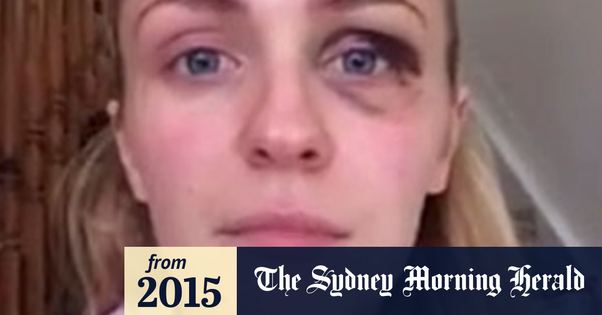 Fitness blogger Emma Murphy shares shocking video with Facebook followers