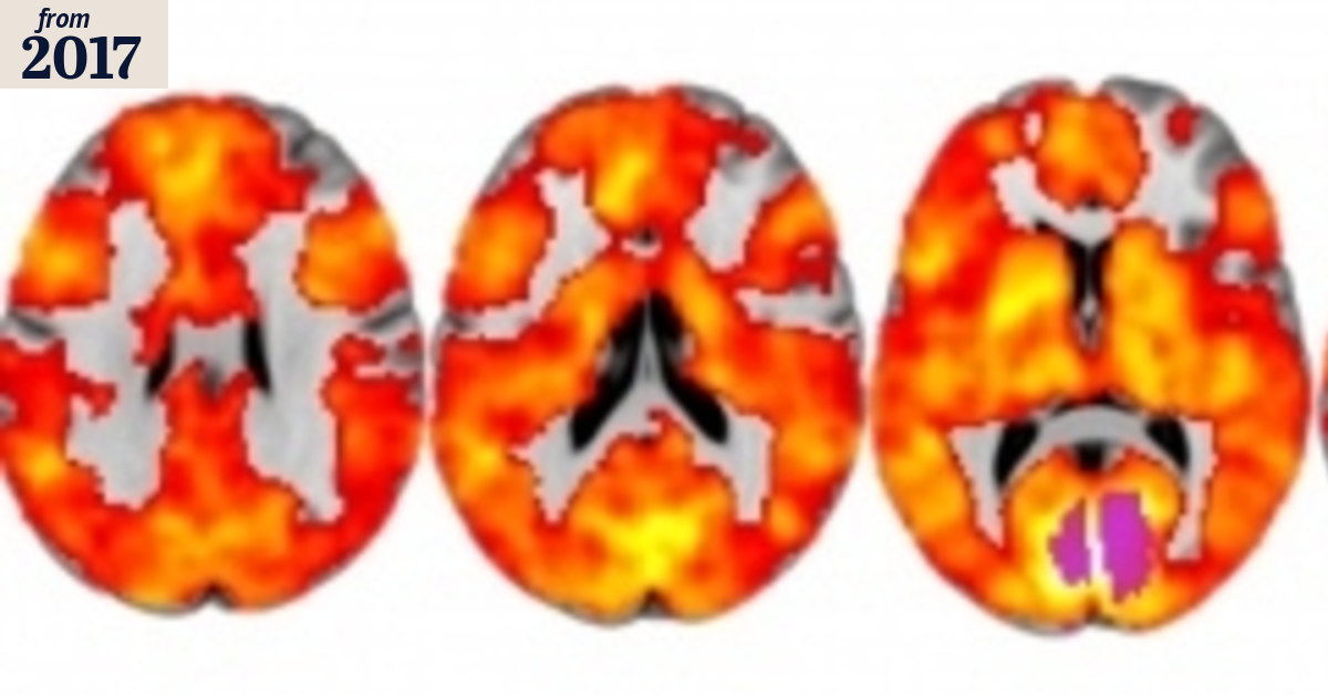 LSD and a terrifying fling with 'ego death' nearly ruined a Sydney teen ...