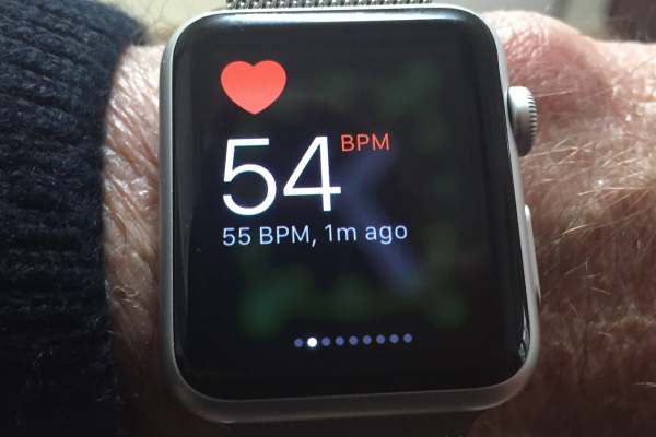 How my Apple Watch saved my life