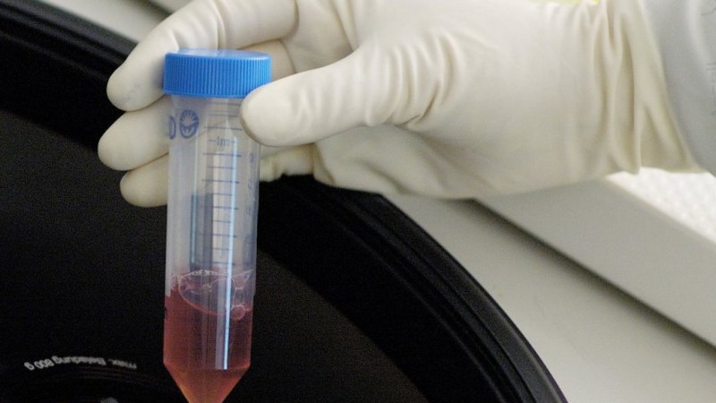 True believer Alex Waislitz is 'still optimistic Mesoblast will succeed'