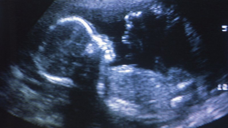 Fifty years, two million babies: Australia's role in a remarkable ...