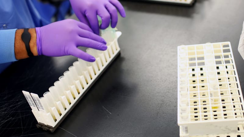 Drug testing company Dorevitch Pathology unfairly sacked worker for ...