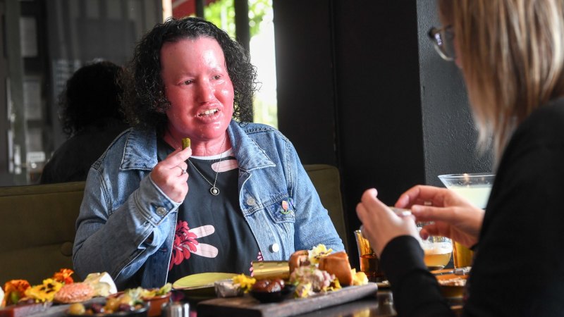 I didn't think disability could be great: Lunch with Carly Findlay