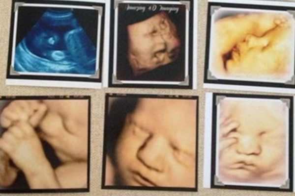 Fake baby ultrasound photos: not guilty plea