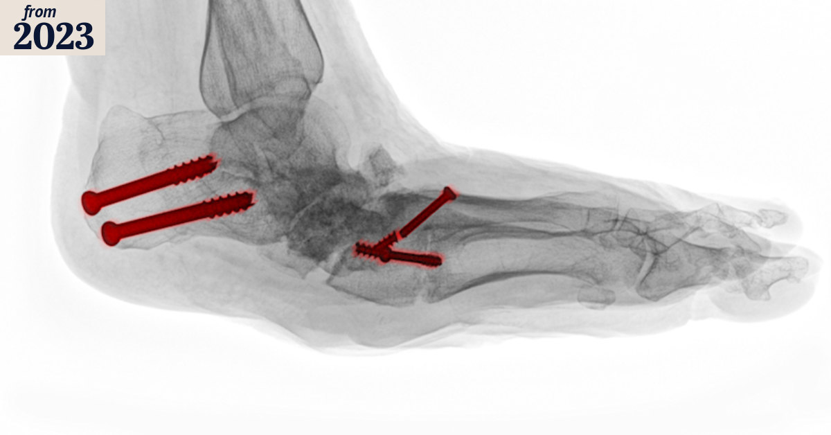 Podiatric surgeons Australia: Private Healthcare Australia calls for ...