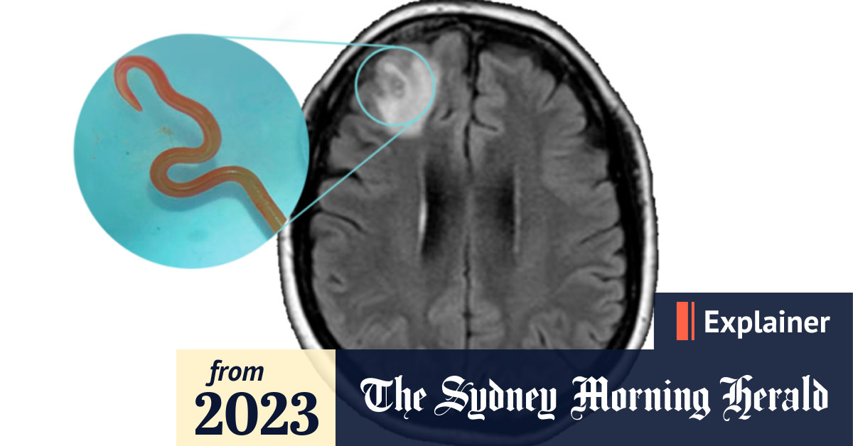 Worm in brain: Did warrigal greens cause a parasite in a human’s brain?