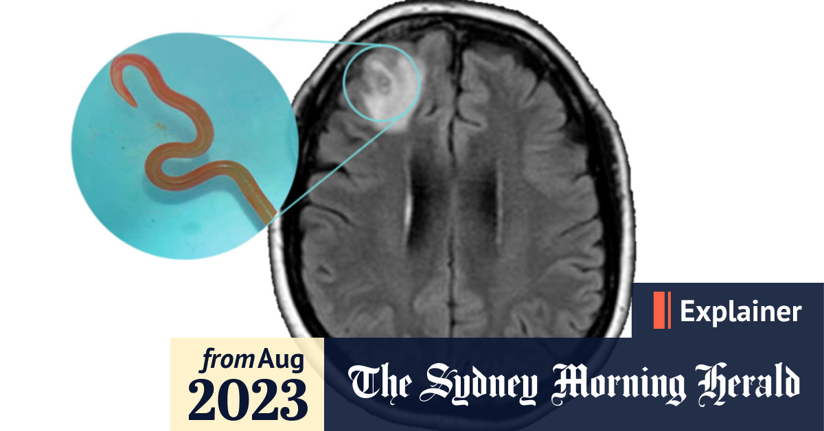 Worm in brain: Did warrigal greens cause a parasite in a human’s brain?