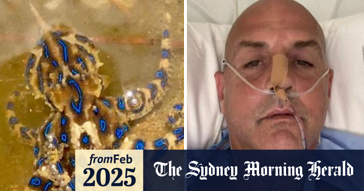 What happens after a blue-ringed octopus bite