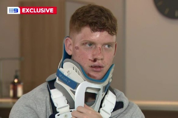 Teenager savagely bashed in unprovoked attack in Scarborough