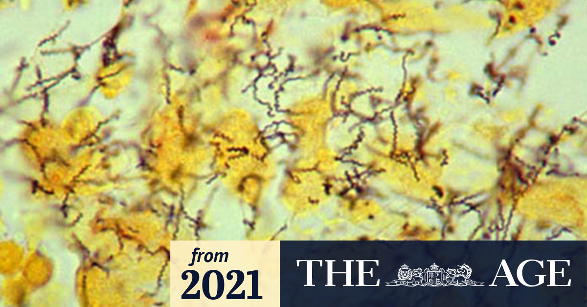Syphilis in Melbourne sparks scientific genomic sequencing to track STD ...