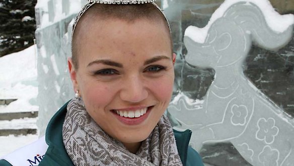 Bald and beautiful: Debbe's a queen for a cause