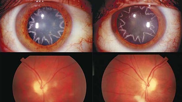 Stars form in electrician's eyes after powerful shock