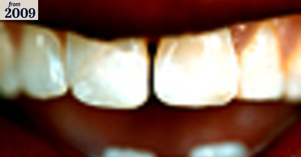 Dentist treated 25 teeth too many