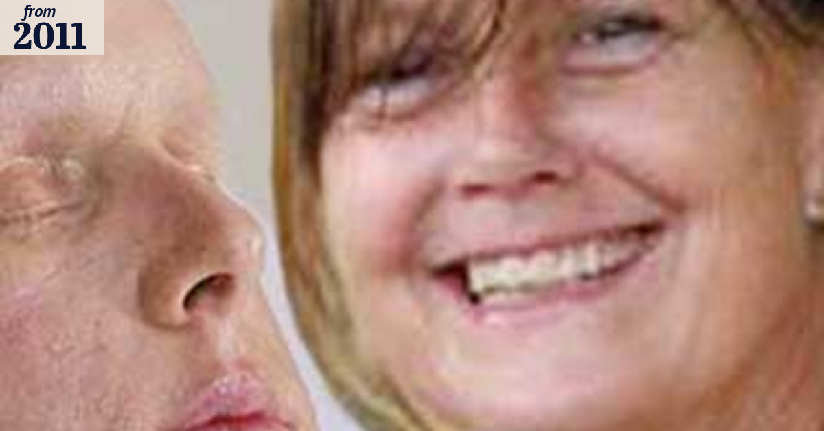 New face of chimp attack victim revealed