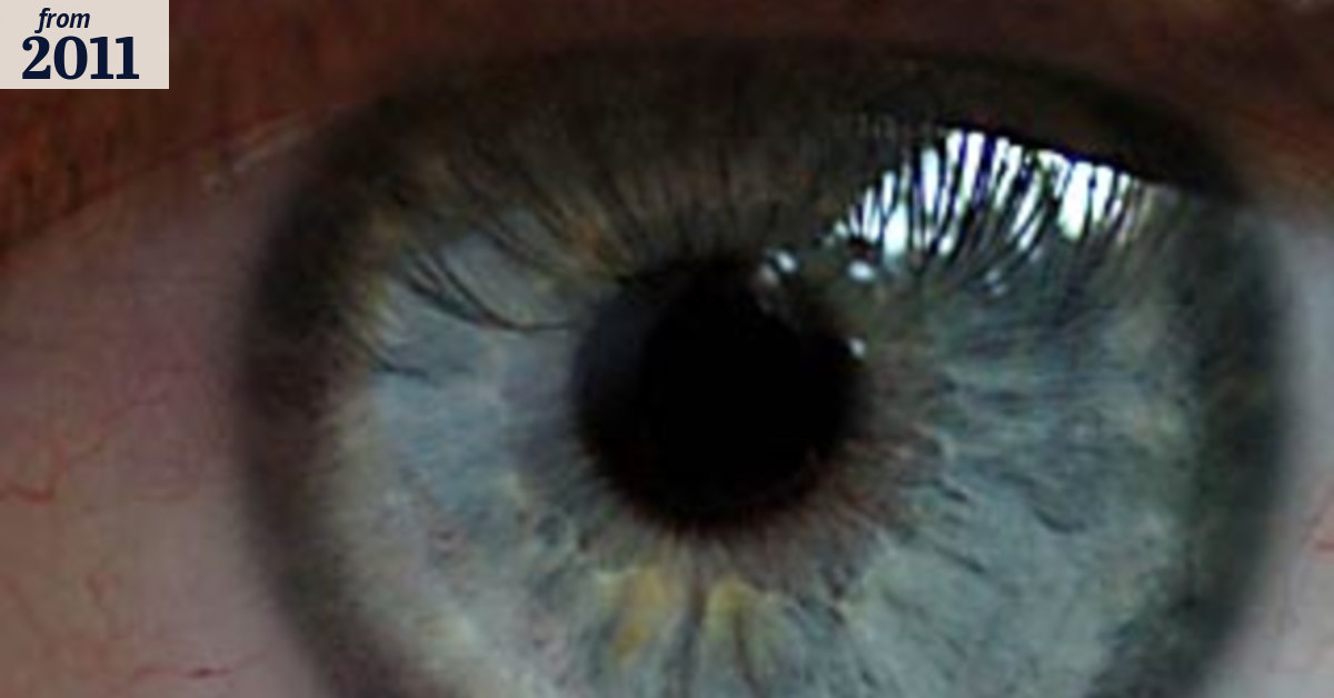 Poke in the eye for $2000 drug - its rival costs just $50