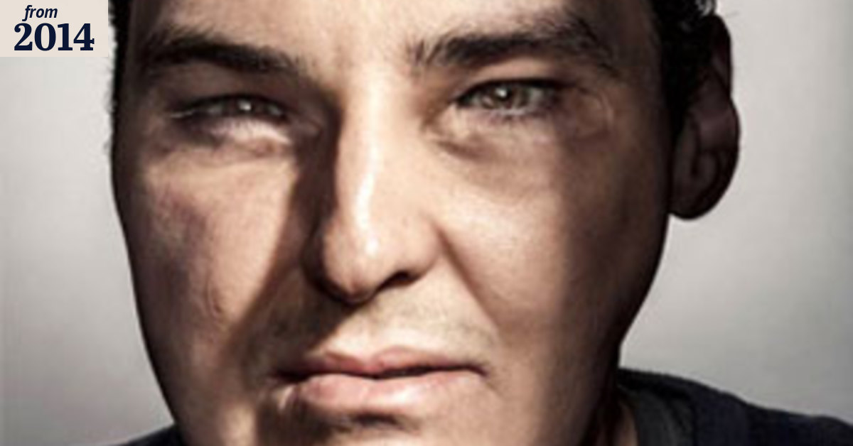 Face transplant man Richard Norris becomes GQ star