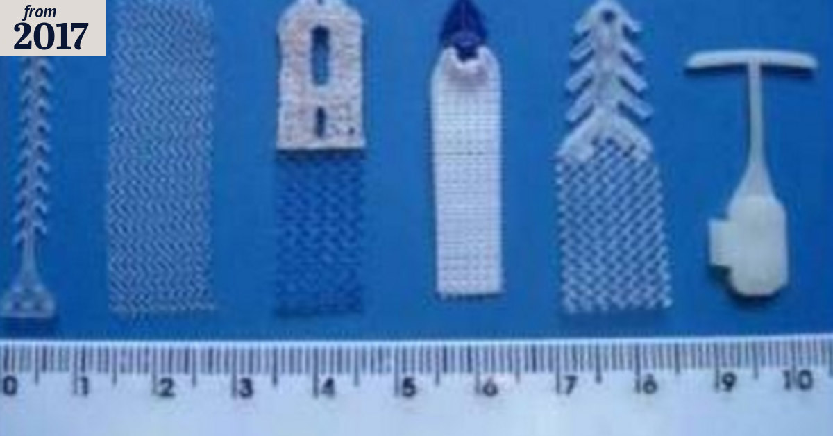 Pelvic mesh victims blamed by 'asleep at wheel' health system, inquiry ...