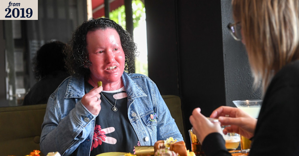 I didn't think disability could be great: Lunch with Carly Findlay